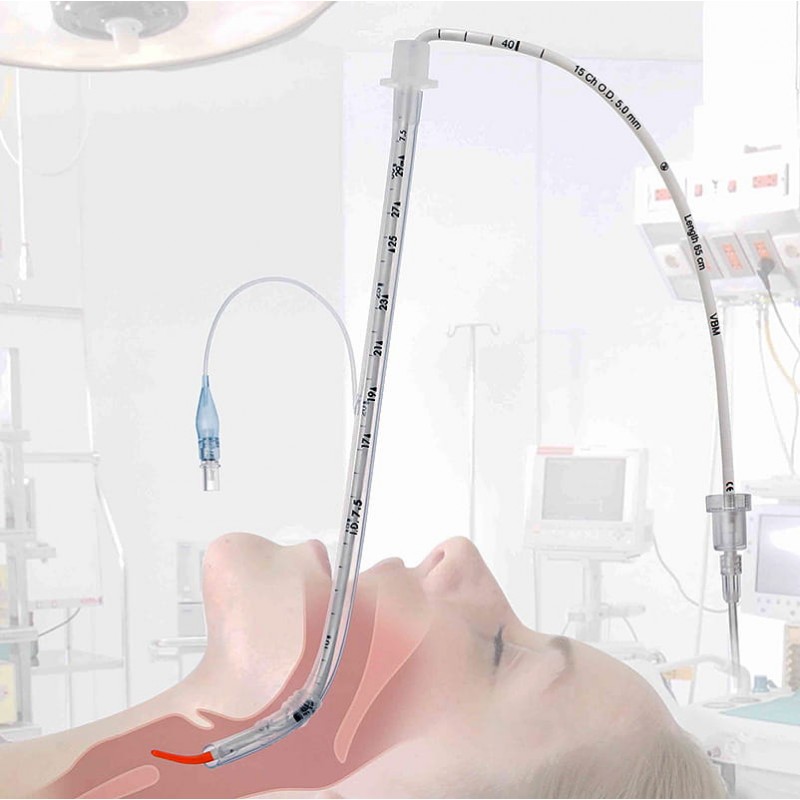 Intubationshilfen Anleitung – Station 8: Endotracheale Intubation beim ...