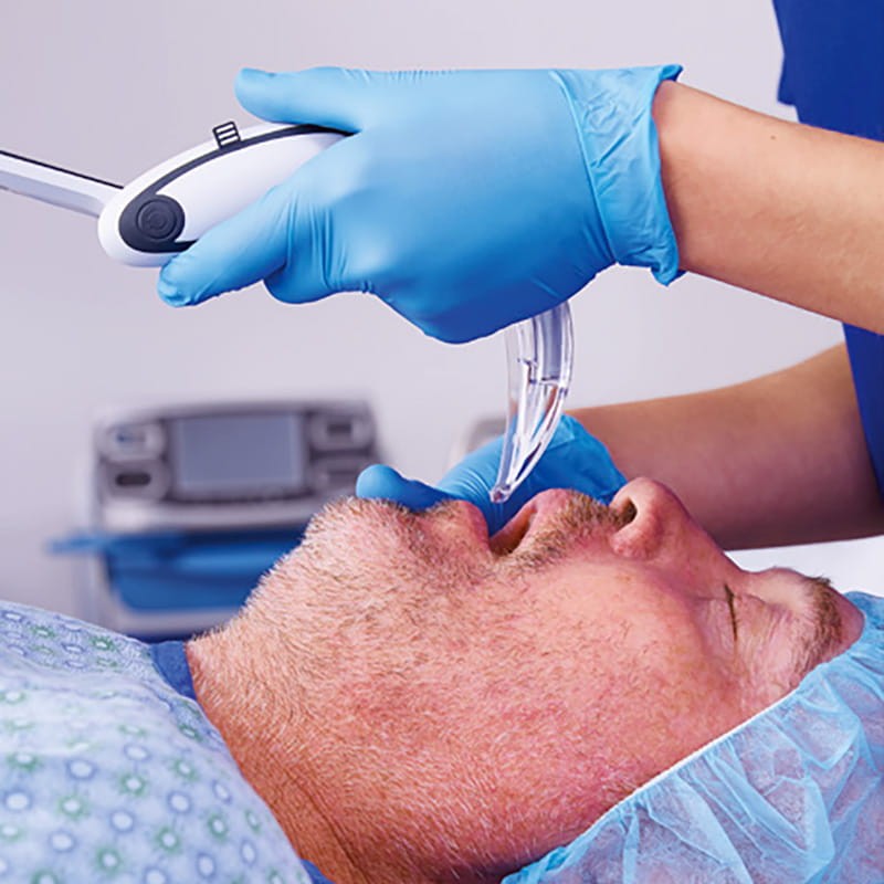 Vidéo-laryngoscope McGRATH™ MAC