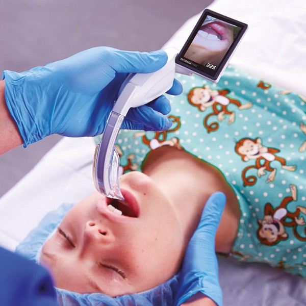 Vidéo-laryngoscope McGRATH™ MAC