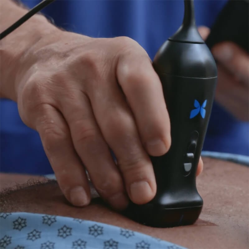 Butterfly iQ3 Ultrasound System