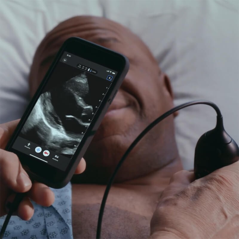 Butterfly iQ3 Ultrasound System